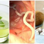 As 15 Receitas Caseiras Para Evitar a Queda de Cabelo | Dr. Saúde